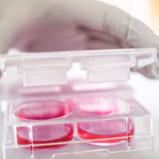 Single Cell Tracking Assay - HoloMonitor® Live Cell Assay - PHI