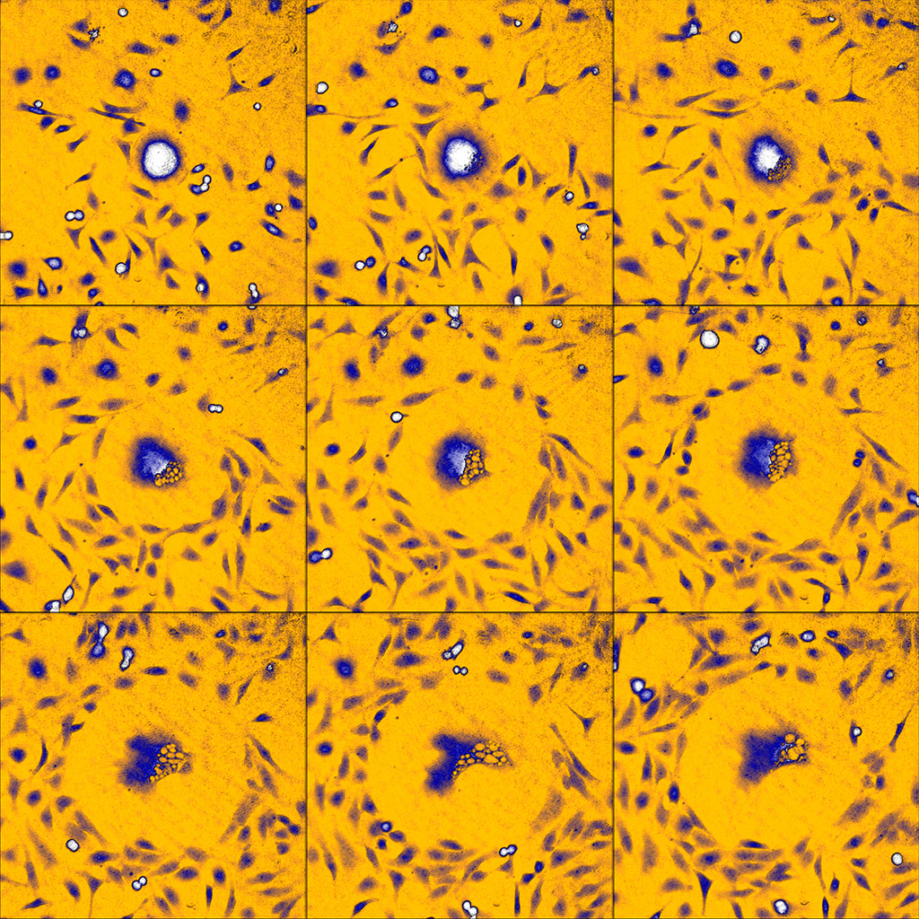 Imaging Cytometry by Holographic Time-lapse Microscopy - PHI