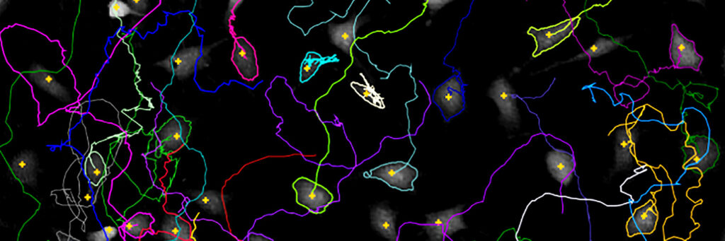 Cell Motility and Migration - PHI