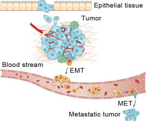 Epithelial-mesenchymal Transition - Huntsman Cancer Institute - PHI