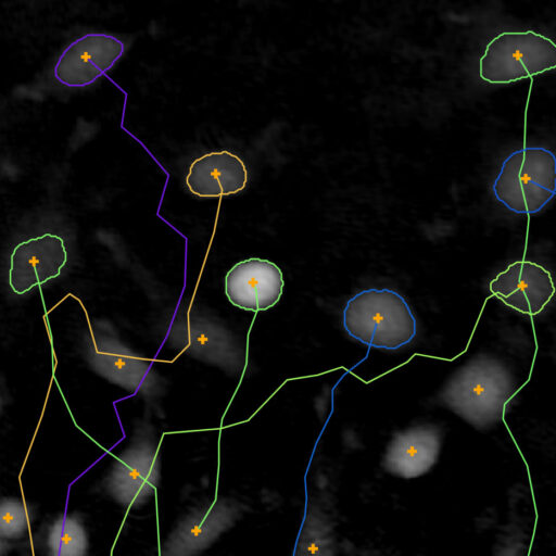 Single Cell Tracking Assay - HoloMonitor® Live Cell Assay - PHI