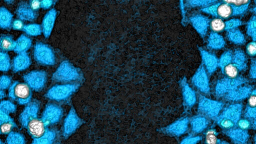 Phase Holographic Imaging - Live Cell Imaging Made Easy