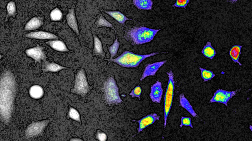 Non-invasive Live Cell Analysis - HoloMonitor® - PHI